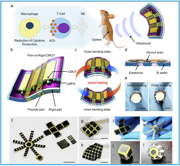 KAIST develops flexible ultrasound sensor that can diagnose and treat ...