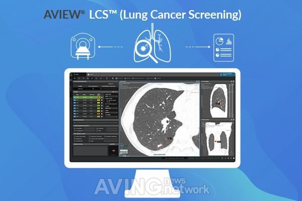 [MIK HOT SPOT_KHIDI] Coreline Soft's lung cancer screening system ...