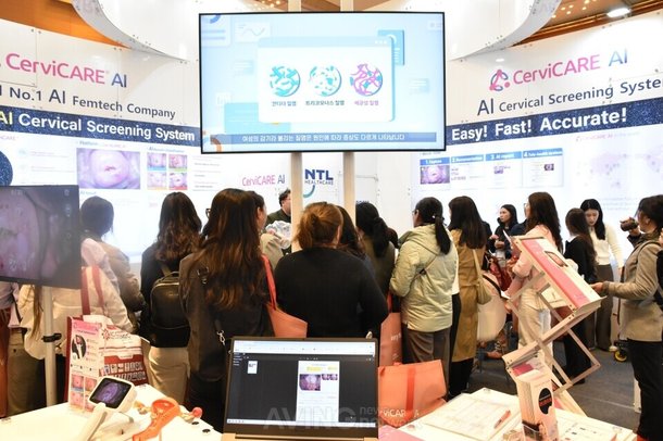 엔티엘헬스케어, KIMES 2025서 'CerviCARE AI' 선보여…"700만 데이터 보유한 인공지능 자궁경부 검진 시스템 ...