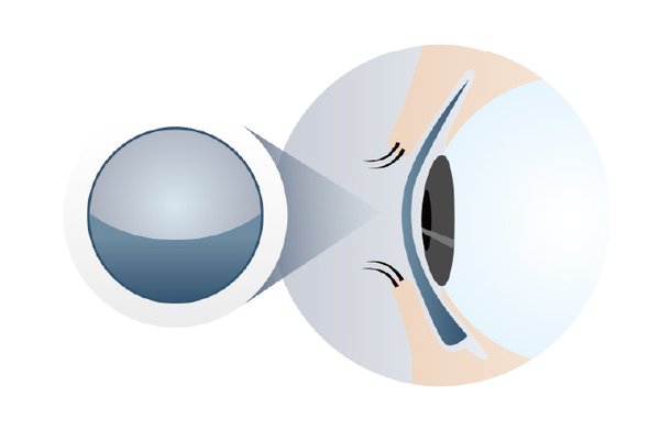 전문적인 난시처방과 질 좋은 서비스는, 소비자로부터 신뢰를 이끌어낸다. : 네이트 뉴스