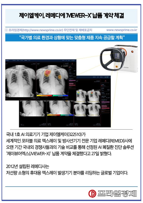 [카드] 제이엘케이, 레메디에 'JVIEWER-X' 납품 계약 체결 : 네이트 뉴스