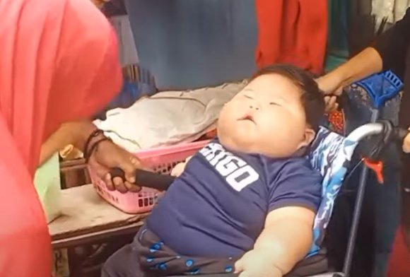 몸무게 27kg, 기저귀도 'XXXL 사이즈'…생후 16개월 아기의 사연 : 네이트 뉴스