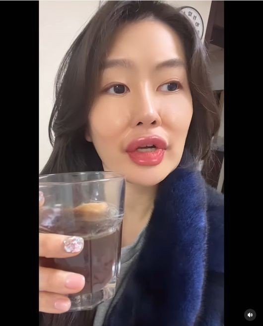 '이용식 딸' 이수민, 88kg→48kg…"입술이 한근이네" 충격 근황 | 아이돌24시 : 네이트 연예