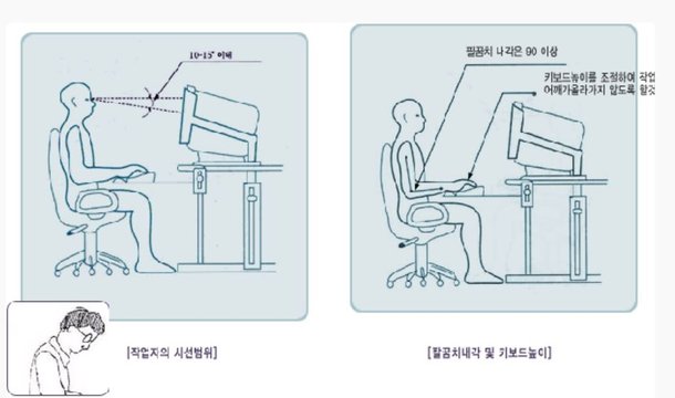 잠깐! 화면에서 눈 떼고 스트레칭하세요···10대 'VDT 증후군' 환자 급증 : 네이트 뉴스