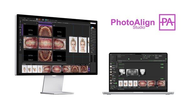 포토얼라인 스튜디오, 치과 임상에 최적화된 프로그램 연동 시스템 공개 : 네이트 뉴스