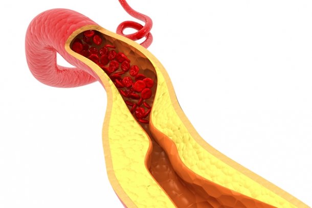 Study Finds Cholesterol Levels Rise Significantly Before Menopause in ...