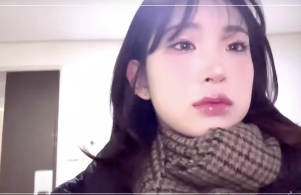 '-44kg' 최준희, 루푸스 병 악화 "스테로이제 늘려…매일 붓는다" [Oh!쎈 리뷰] | 네이트 연예