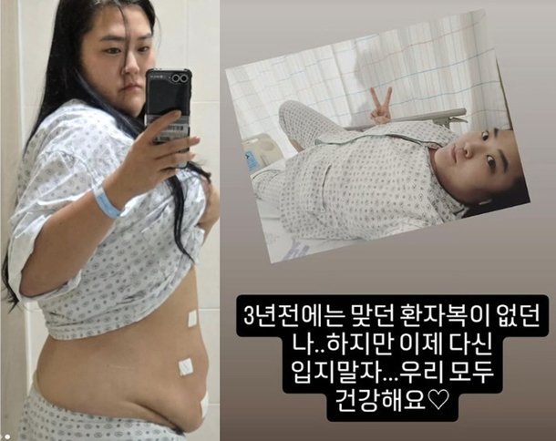 '150→99kg' 미나 시누이, 맞는 환자복도 없던 뚱뚱 과거 '충격' : 네이트 연예