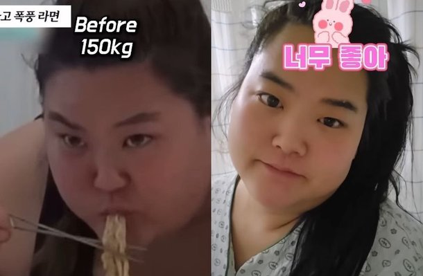 '미나 시누이' 수지, 150kg→99kg 다이어트 성공 "미뤘던 탈장수술도 받아"('필미부부') | 아이돌24시 : 네이트 연예
