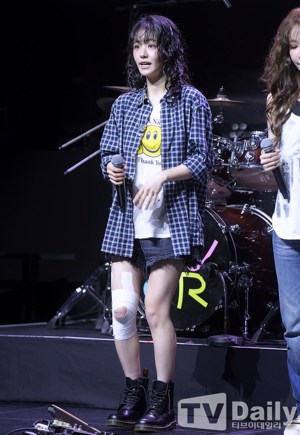 [TD포토] QWER 쵸단 '안타까운 다리 부상' : 네이트 연예