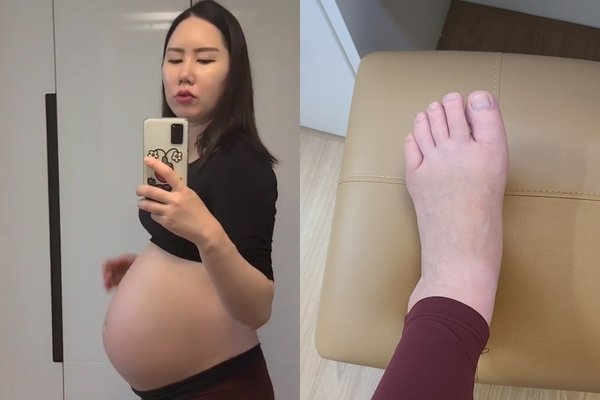 '세쌍둥이 임신' 황신영, 84.6kg 퉁퉁 부은 몸…"더 무거워져" [전문] : 네이트 연예