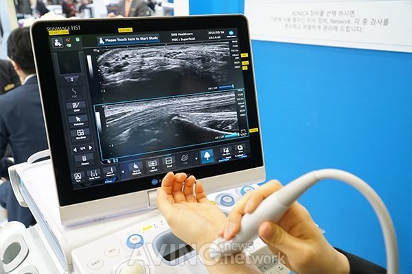 [KIMES 2018 Video] Konica Minolta · United imaging Healthcare showing ...