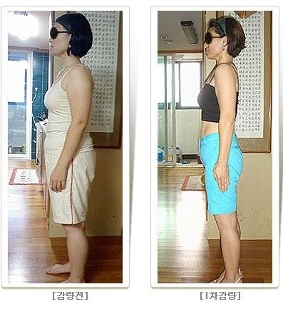 생생한의원 백비탕 다이어트 성공사례 29 - 서울시 용산구 이촌동 남 모씨 : 네이트 뉴스